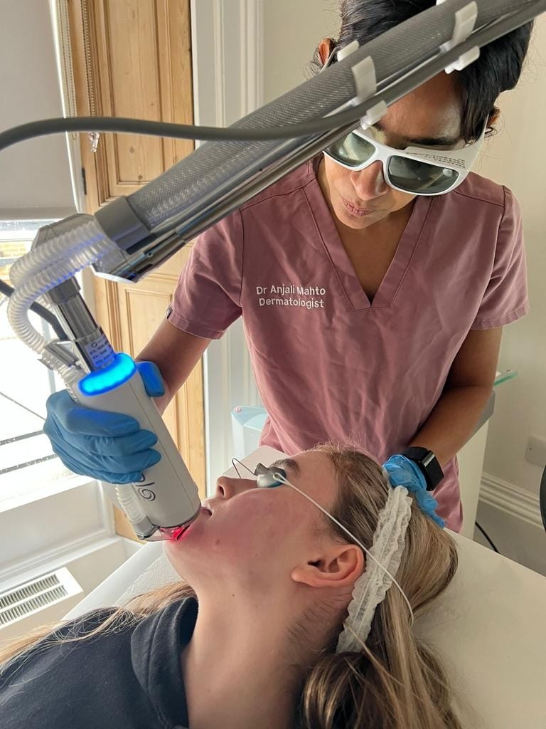 Resurfacing Lasers - Self London